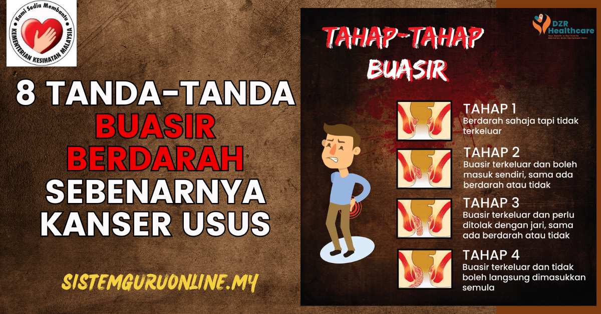 8 Tanda-tanda Buasir Berdarah Mungkin Sebenarnya Kanser Usus