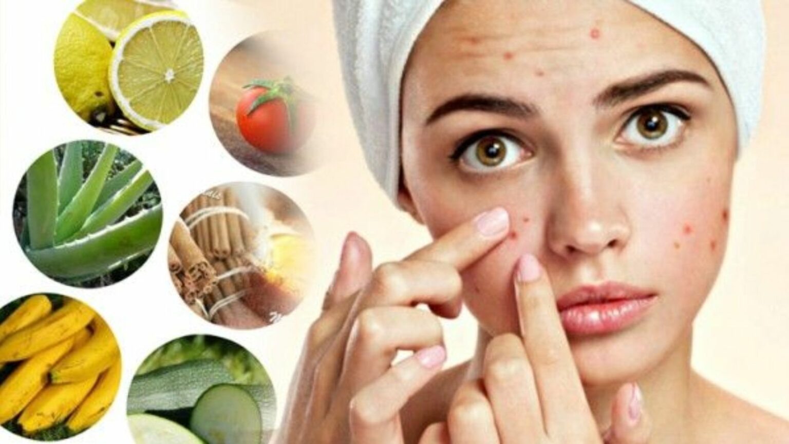 5 Punca Dan Gejala Jerawat Batu Beserta Cara Menghilangkan Jerawat Batu