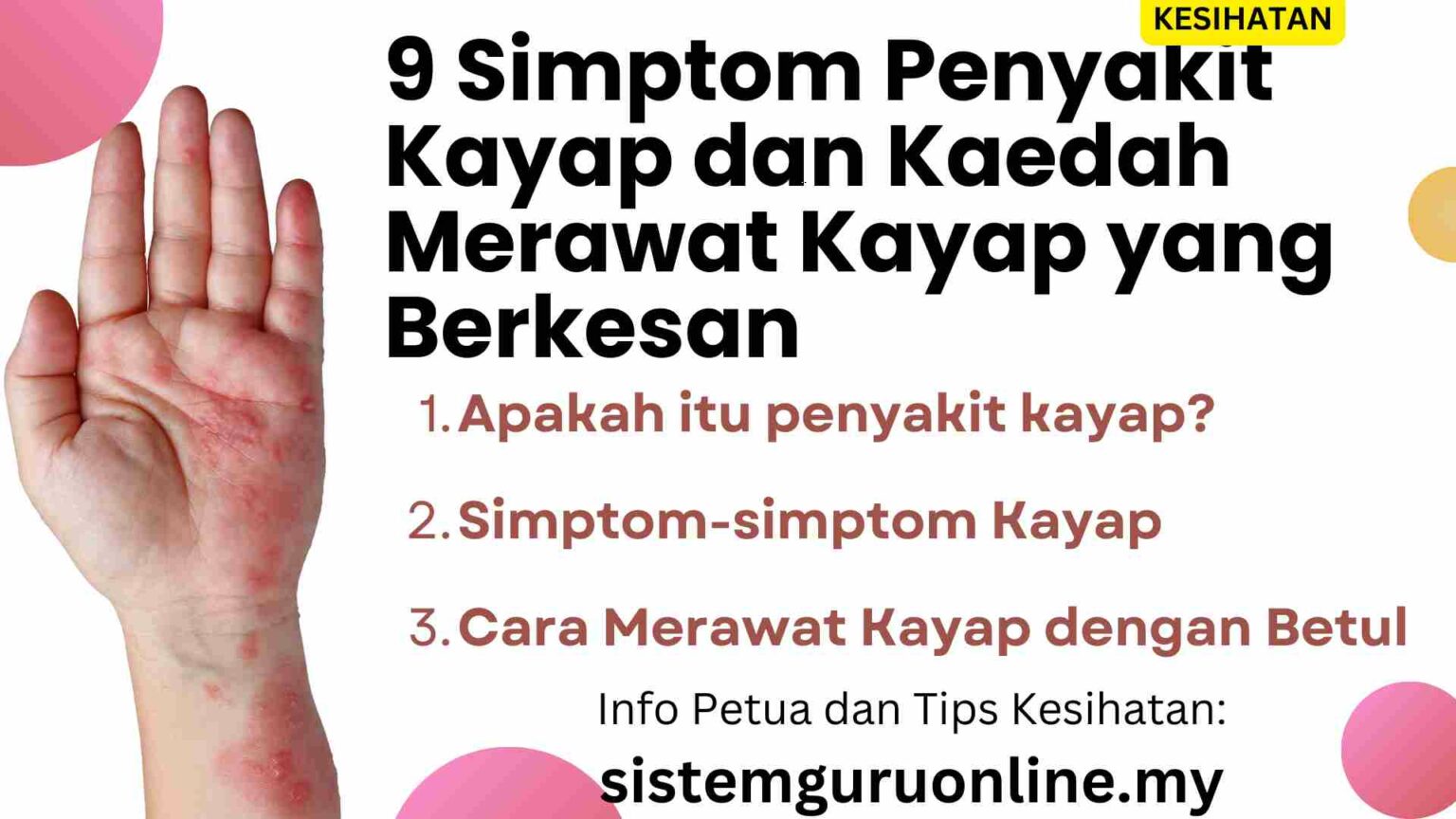 9 Simptom Penyakit Kayap Dan Kaedah Merawat Kayap Yang Berkesan