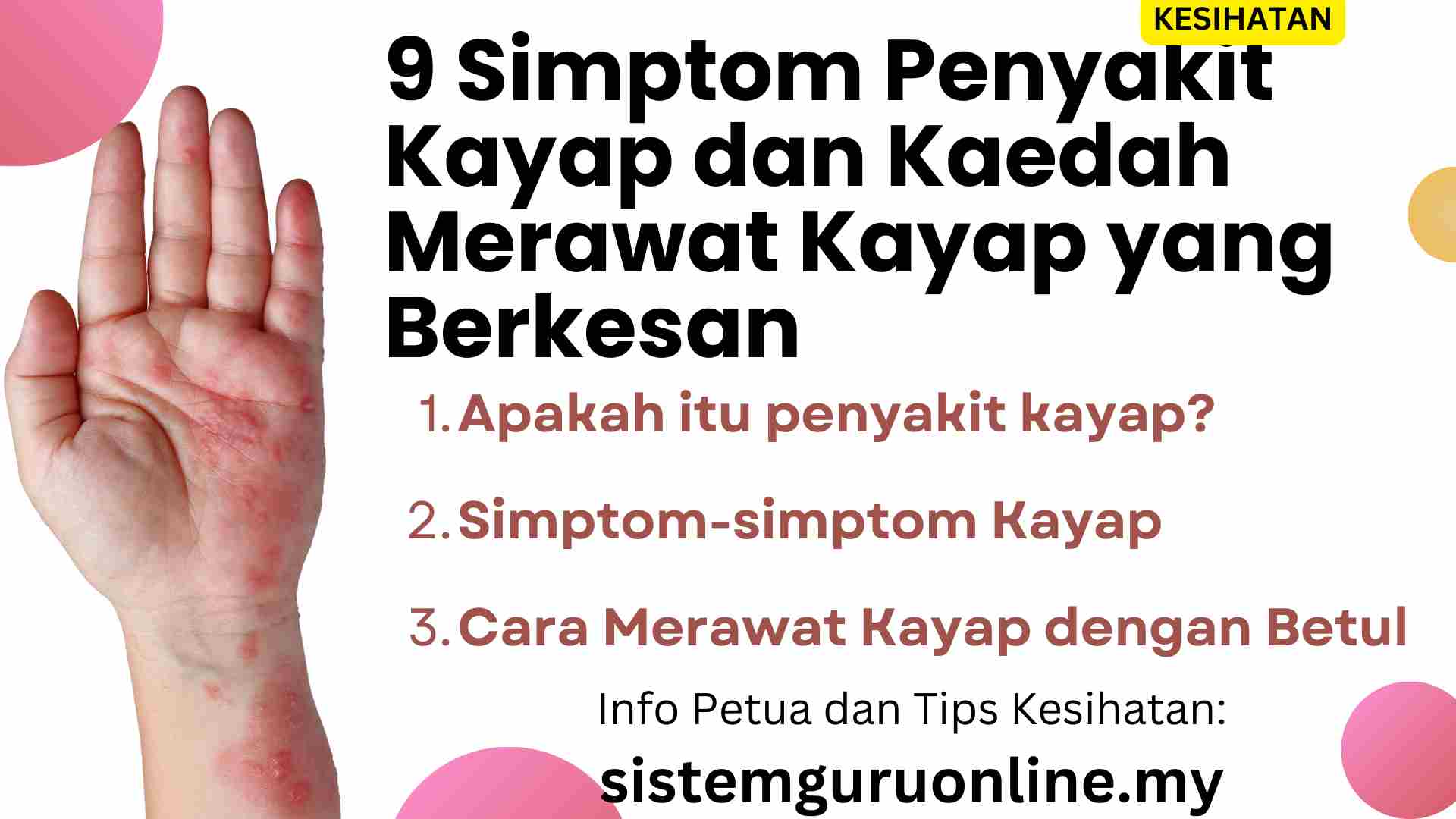9 Simptom Penyakit Kayap Dan Kaedah Merawat Kayap Yang Berkesan