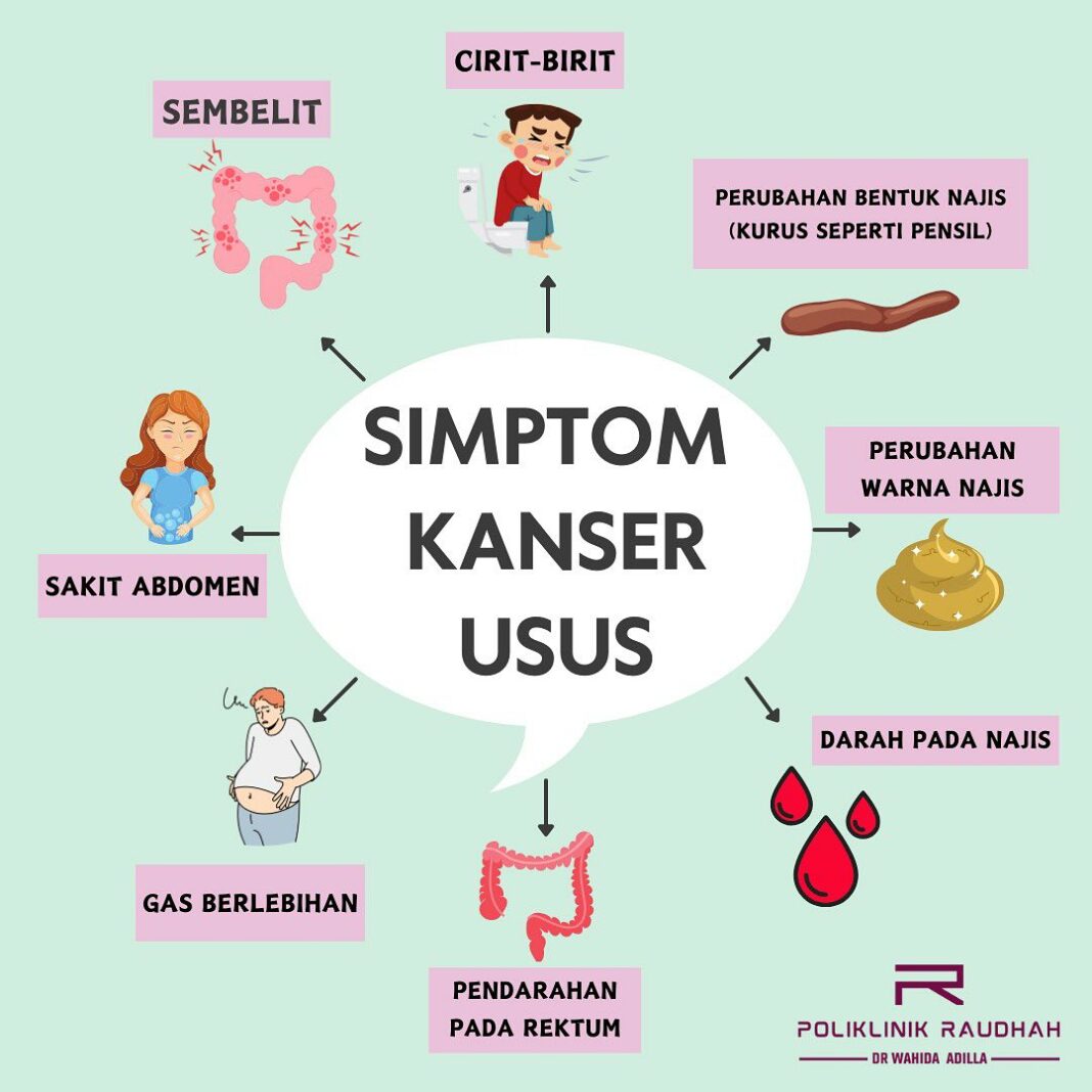 7 Gejala Awal Kanser Usus Dan Ujian Diagnosis Kanser Usus