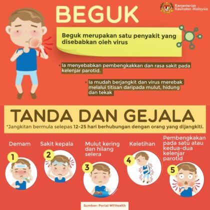 Beguk Mudah Menjangkit Pada Kanak-kanak Dan 5 Gejala Jangkitan Virus Beguk