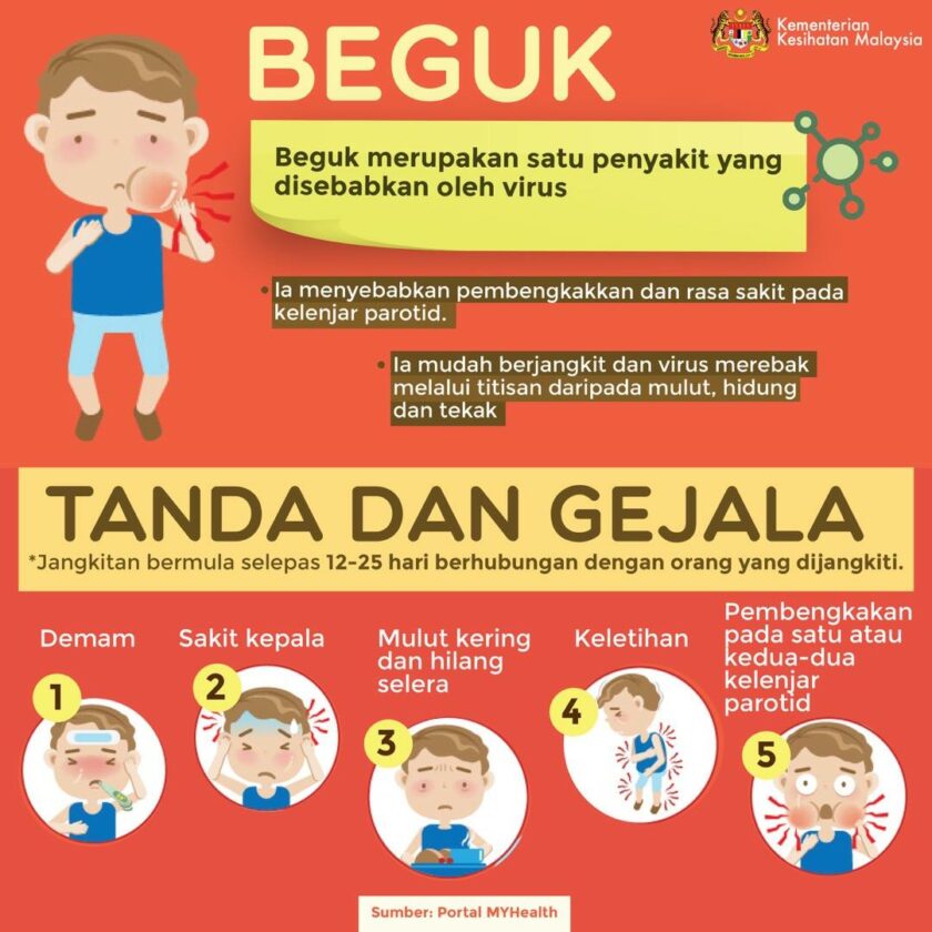Beguk Mudah Menjangkit Pada Kanak-kanak Dan 5 Gejala Jangkitan Virus Beguk
