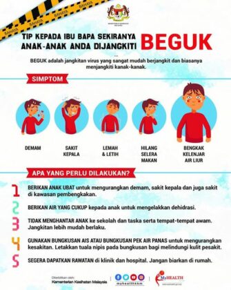 Beguk Mudah Menjangkit Pada Kanak-kanak Dan 5 Gejala Jangkitan Virus Beguk