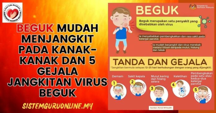 Beguk Mudah Menjangkit Pada Kanak-kanak Dan 5 Gejala Jangkitan Virus Beguk