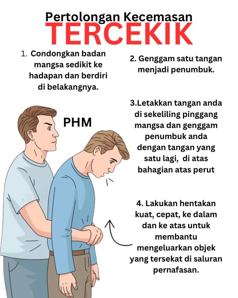Lengkap Teknik Heimlich Maneuver Bila Tercekik