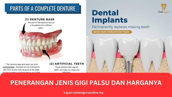 Penerangan Jenis Gigi Palsu Dan Harganya