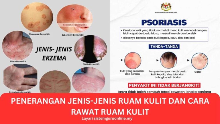 Penerangan Jenis-Jenis Ruam Kulit Dan Cara Rawat Ruam Kulit